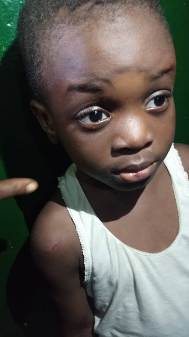 Step Mother Arrested For Inflicting Injuries On 4-Year Old Step ...