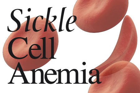 Sickle Cell: Niprisan May Return - P.M.EXPRESS